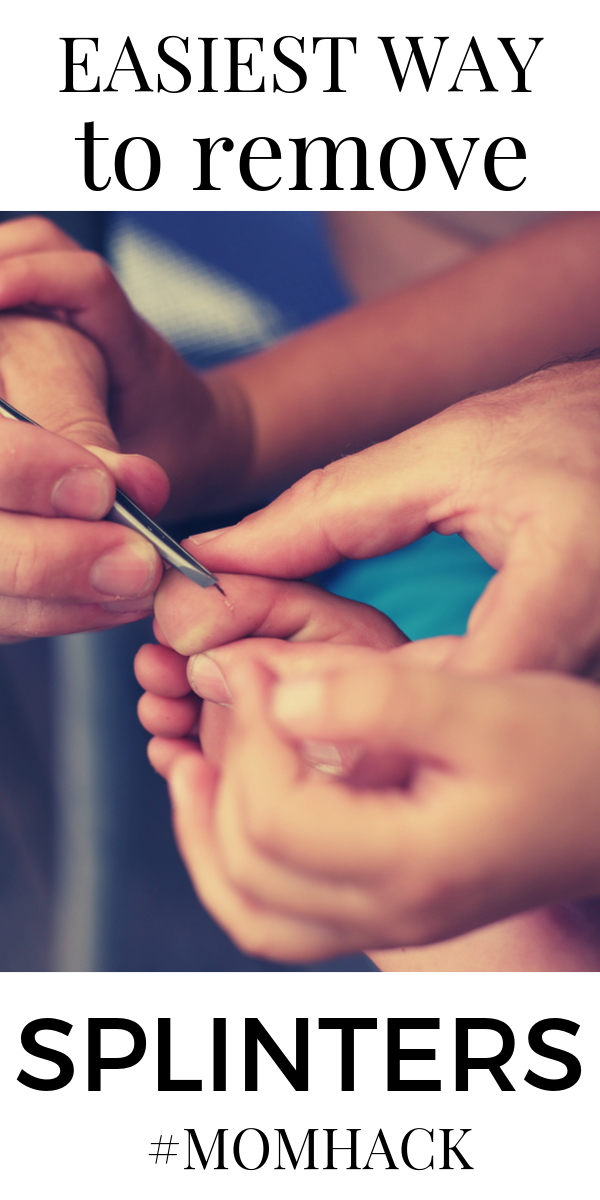 How to Remove a Splinter - Stylish Life for Moms