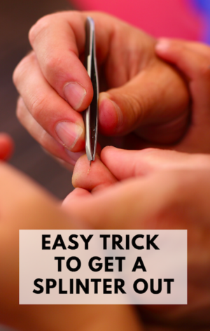 How to Remove a Splinter - Stylish Life for Moms