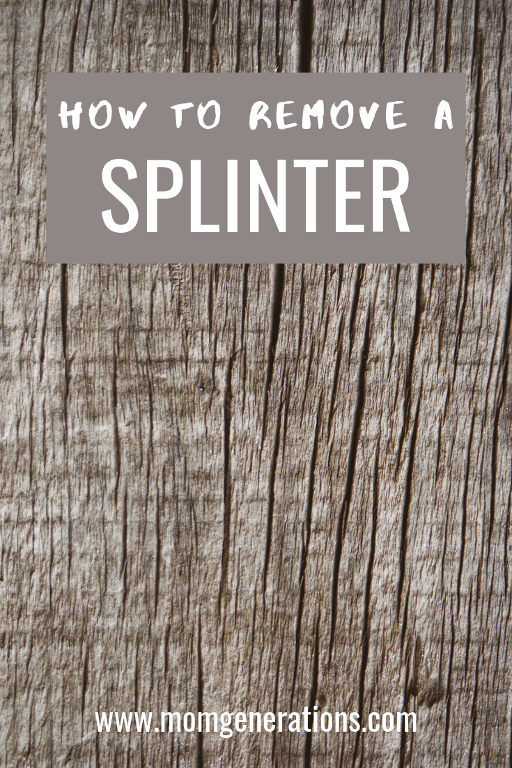 How to Remove a Splinter - Stylish Life for Moms