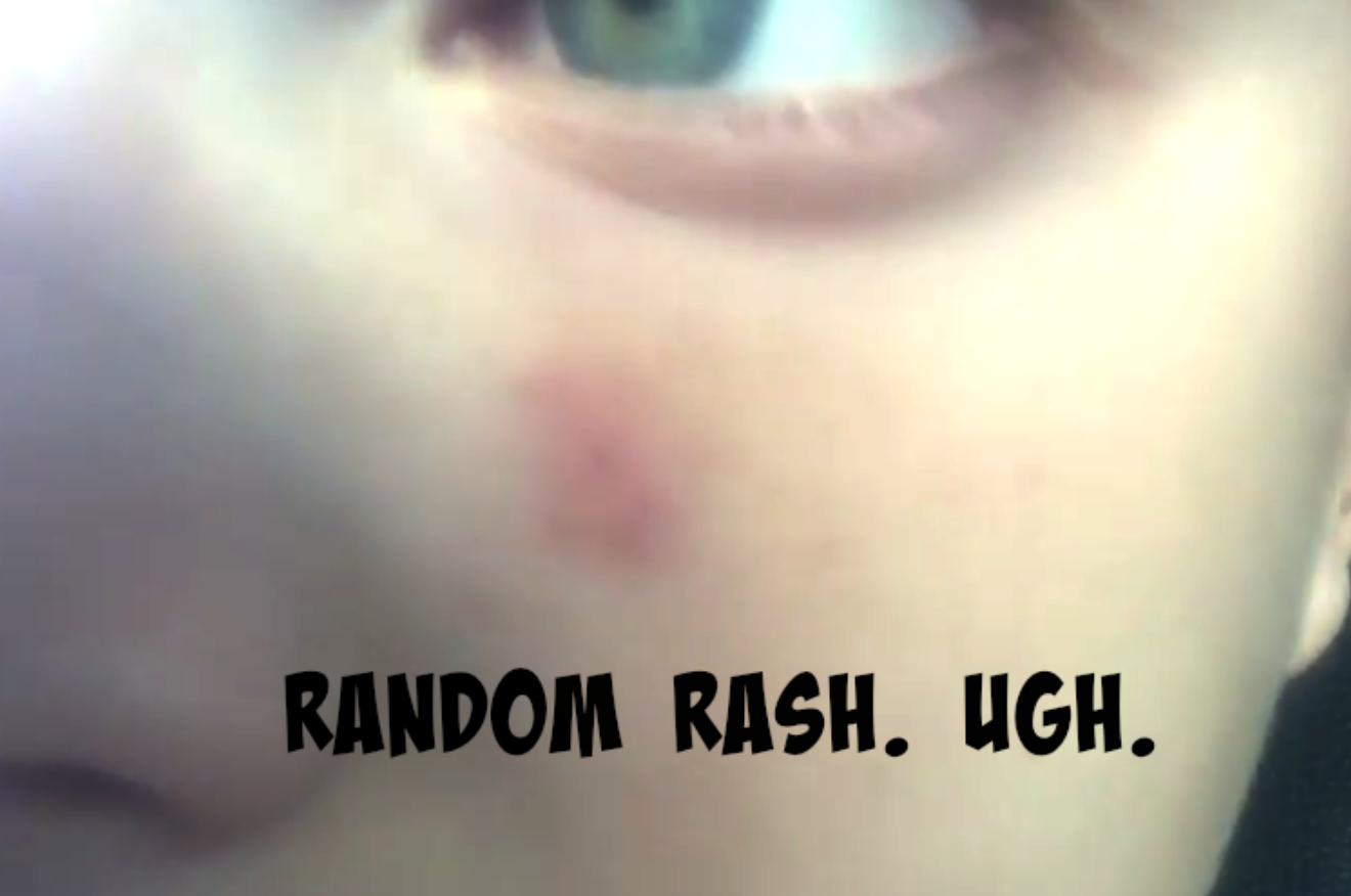 Daily Video: Random Rash, Eyebrow Waxing and Halloween - Stylish Life ...